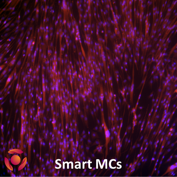 Next Generation Microcarriers- Smart MCs