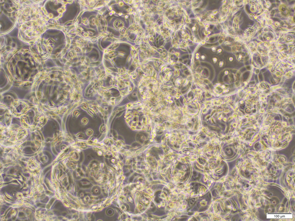 P1 Microcarriers - Smart Biomaterials & µ-Solutions- Smart MCs