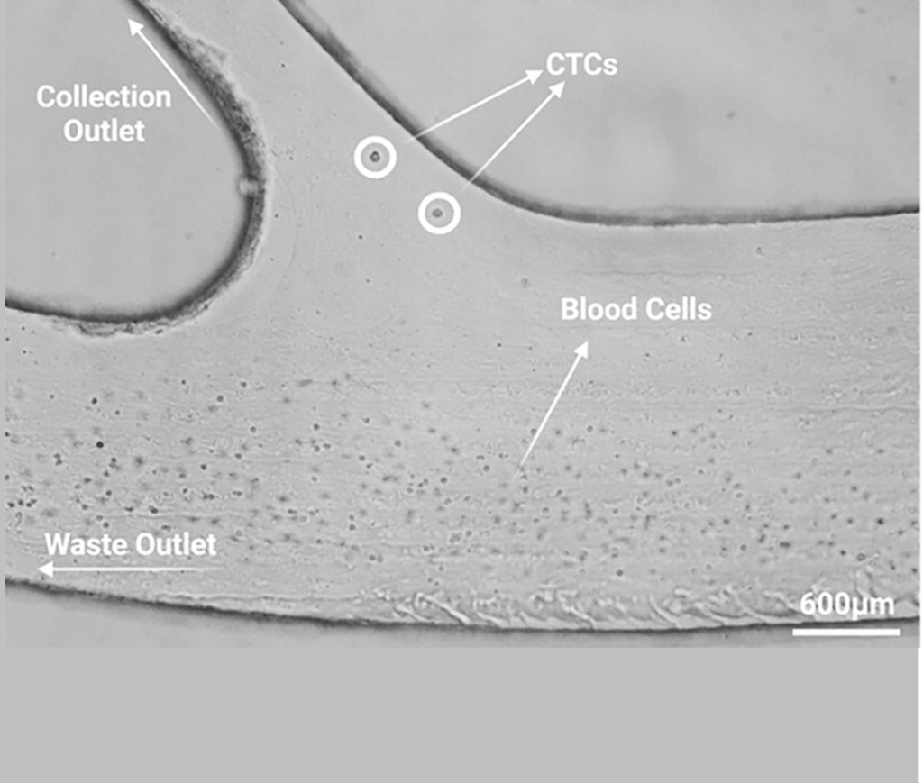 Label-Free Circulating Tumour Cell Isolation - Smart Biomaterials & µ ...