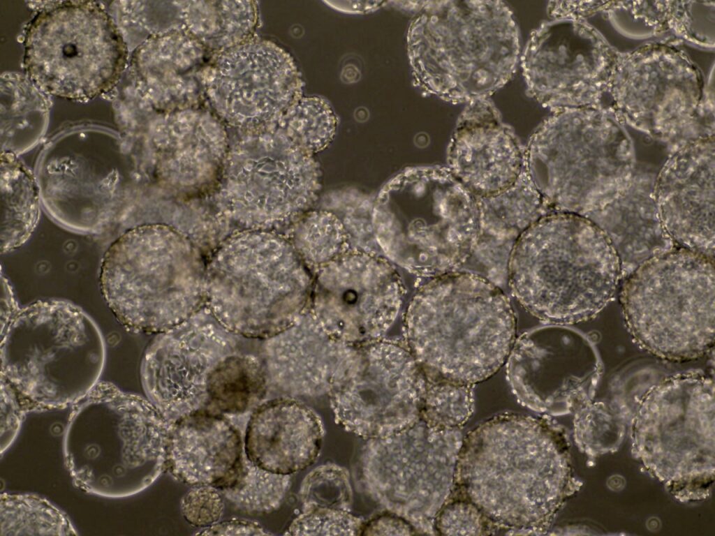 P2 Microcarriers - Smart Biomaterials & µ-Solutions- Smart MCs